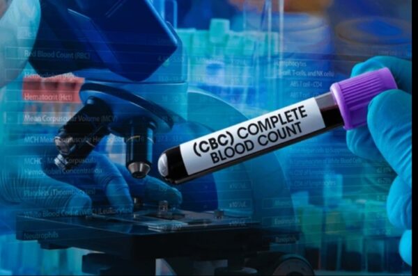 Complete Blood Tests - ryanscan